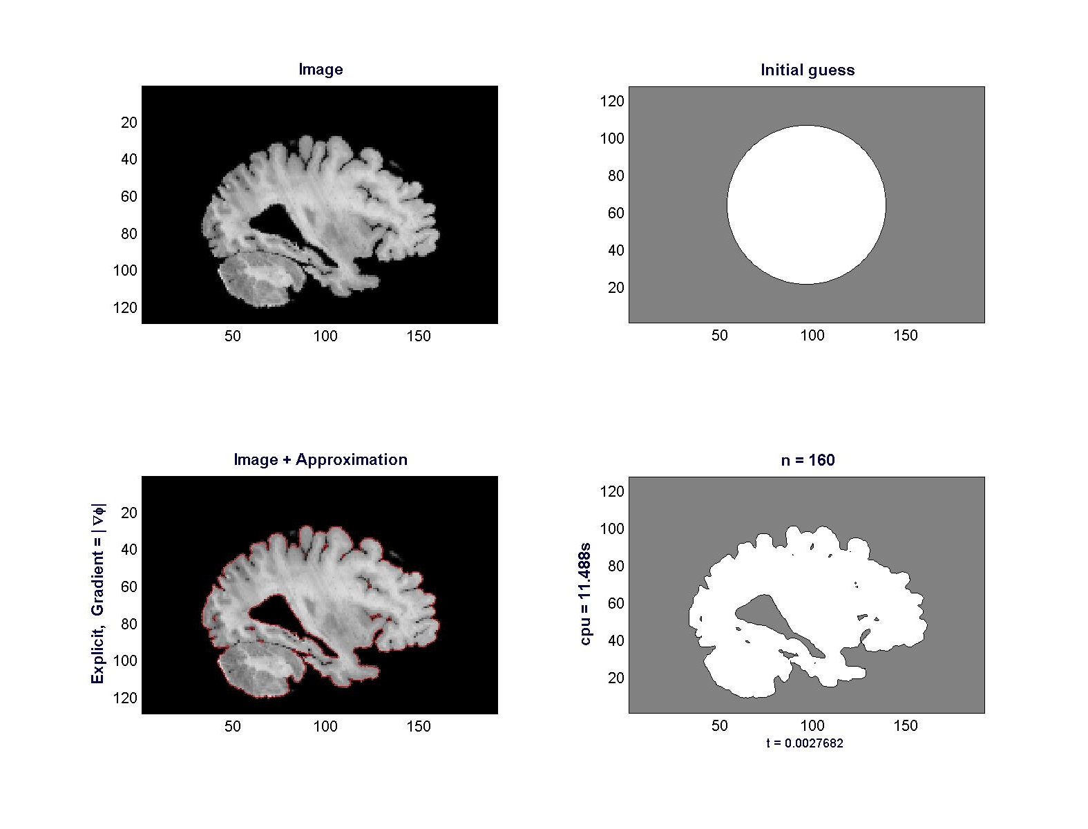 Image Segmentation