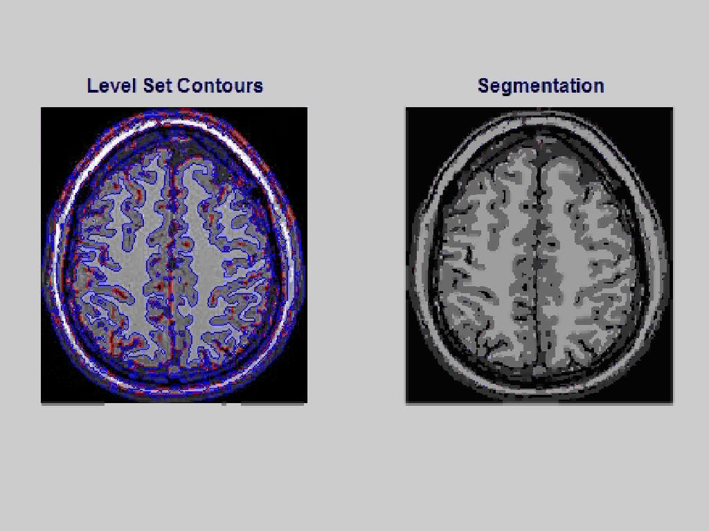 Medical Imaging
